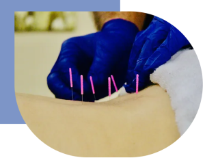 Dry Needling Therapy | Relieve Muscle Pain & Improve Mobility